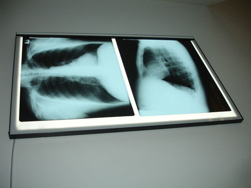 4 Bay Slimline LED X-Ray Viewer - X Ray Light Box