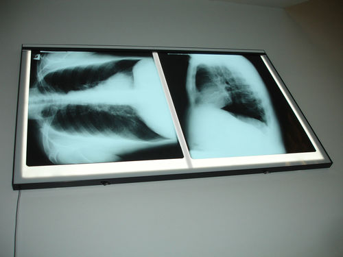 3 Bay Slimline LED X-Ray Viewer - X Ray Light Box